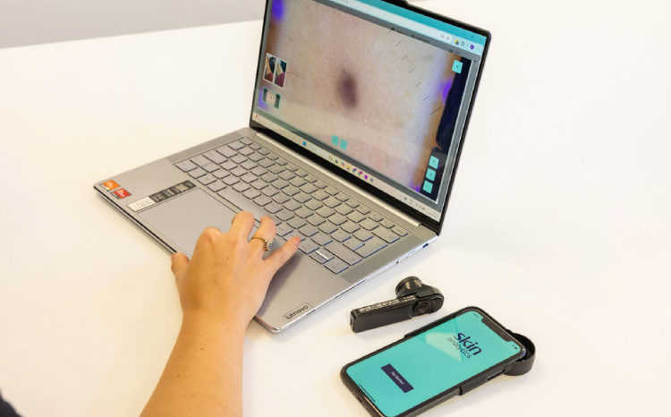 Skin Analytics raises £15m to expand AI skin cancer detection tech